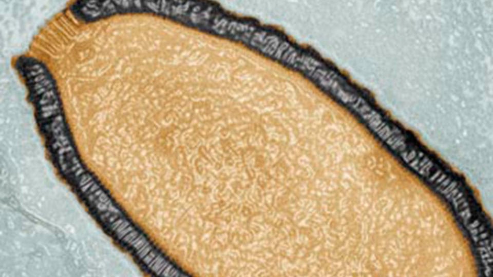 Pithovirus un nuevo virus gigante que sobrevive durante 30.000 años
