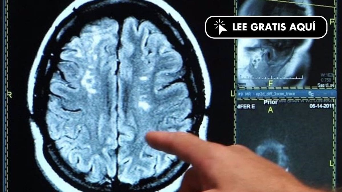 Una nueva técnica permite una visión sin precedentes del cerebro en ...