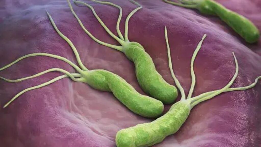 Helicobacter pylori: qué es, cómo averiguar que lo tienes y cómo ...