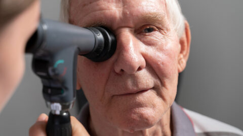 Arco senil: qué es y por qué aparece este borde blanquecino alrededor ...