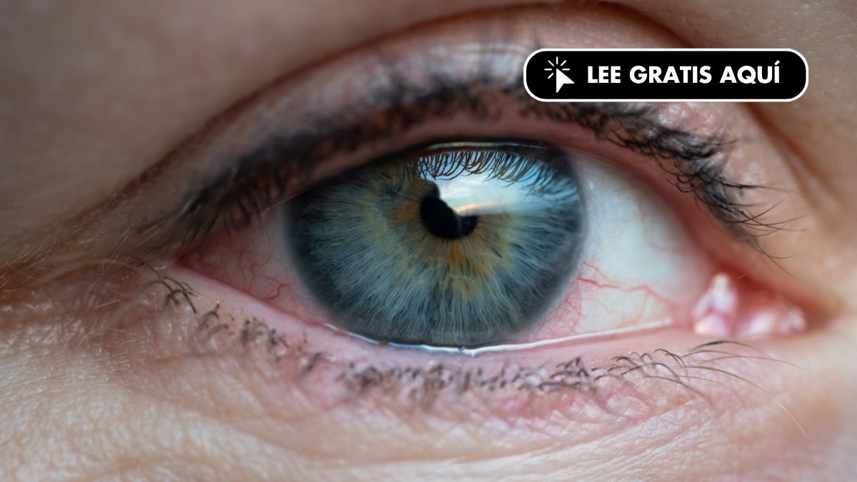 El principal síntoma del cáncer ocular: lo que debes saber para un ...