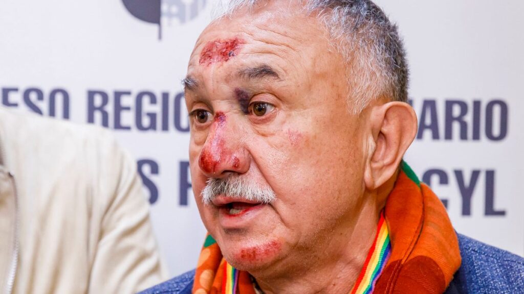 Pepe Álvarez reaparece con la cara llena de heridas en el Congreso de UGT de Segovia